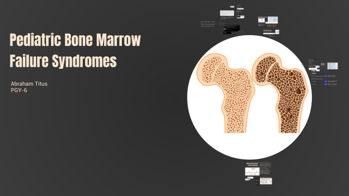 Pediatric Bone Marrow Failure Syndromes: Clinical Insights for ...