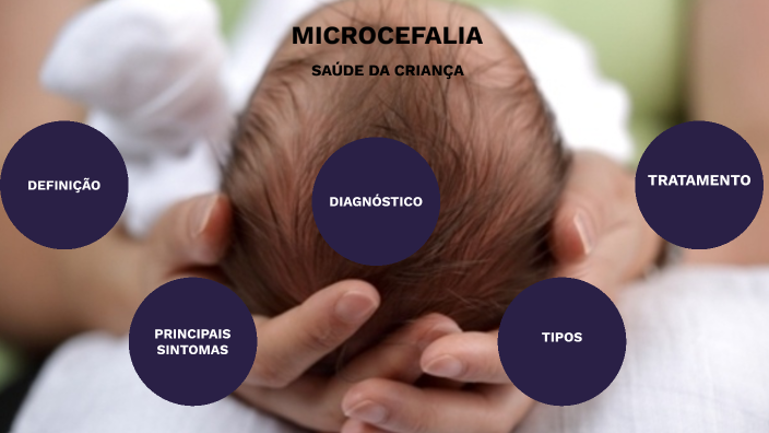 Microcefalia by Leiliane silva on Prezi