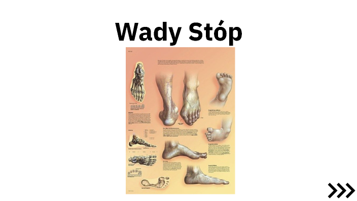 Wady stóp by Wiktor Bogdan on Prezi