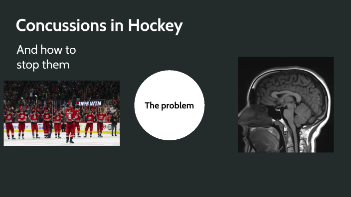 How to stop concussions by Bryson Parker on Prezi
