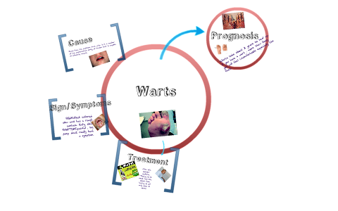 warts by Jessica Grindle on Prezi