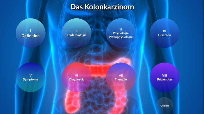 Kolonkarzinom by B T on Prezi
