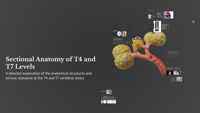Sectional Anatomy of T4 and T7 Levels by Rukshan Surangana on Prezi