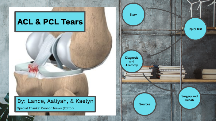 PCL & ACL Tear by Lance Ponsaran on Prezi