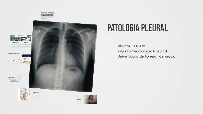 Understanding Pleural Pathology by a a on Prezi