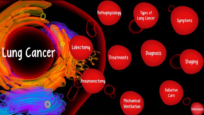 Lung Cancer by Lexi Dyer on Prezi