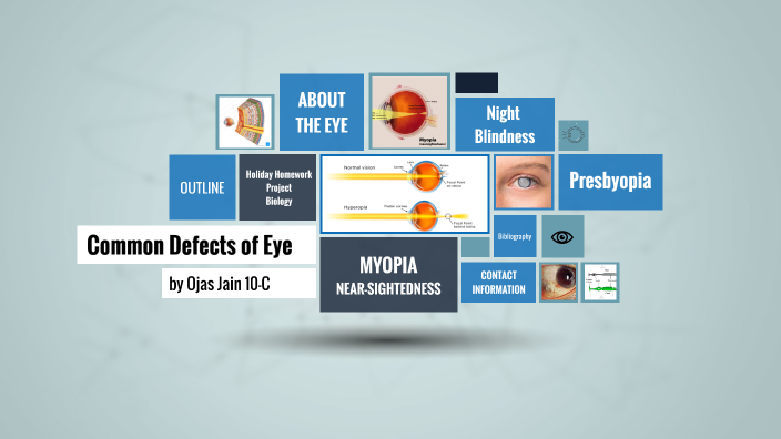 The Common Defects of Eyes by ojas jain on Prezi