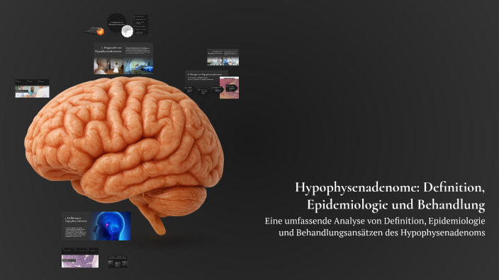 Hypophysenadenome: Definition, Epidemiologie und Behandlung by Maria ...