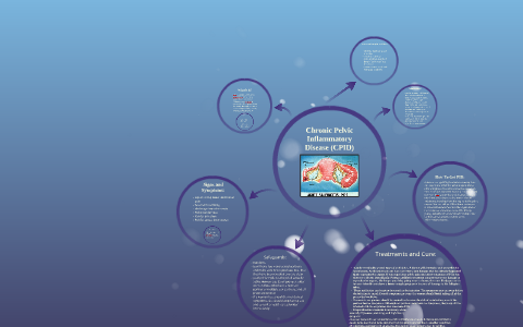 Chronic Pelvic Inflammatory Disease (CPID) by on Prezi