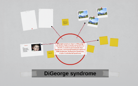 DiGeorge syndrome by on Prezi