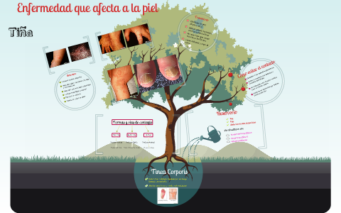 Enfermedad Tiña by Natalya Garzón