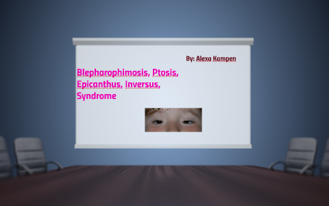 Blepharophimosis Ptosis Epicanthsersus Inversus Syndrome by Jason ...