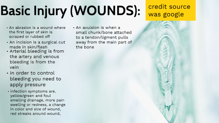 Basic Injury by Abigail Coughlin on Prezi