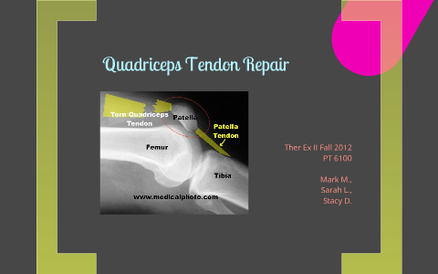Quadriceps Tendon Repair by Mark Mitchell on Prezi