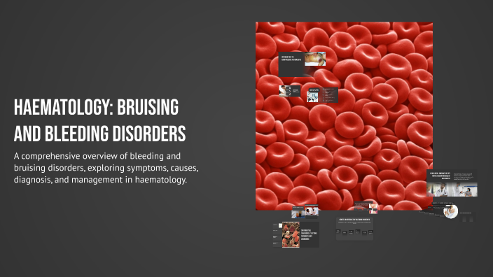 Haematology: Bruising and Bleeding Disorders by Cerys Jones on Prezi