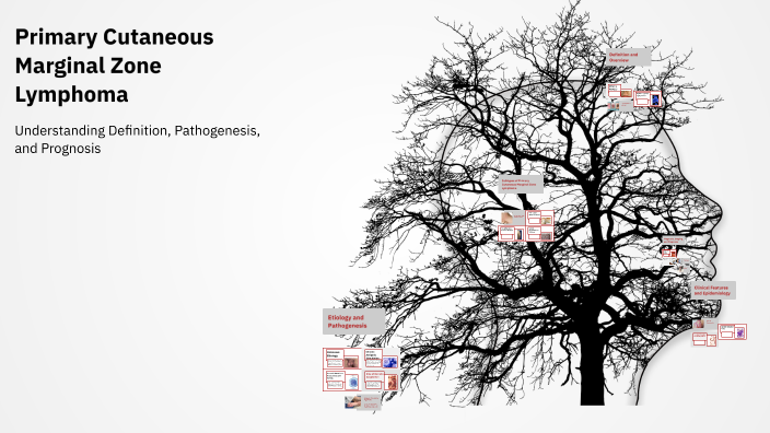 Primary Cutaneous Marginal Zone Lymphoma by on Prezi