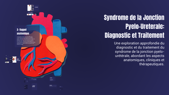 Syndrome de la Jonction Pyelo-Ureterale: Diagnostic et Traitement by ...