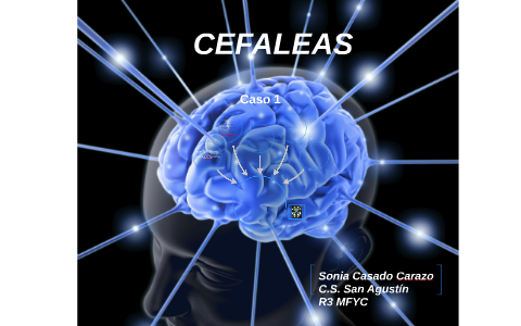 CEFALEAS by on Prezi