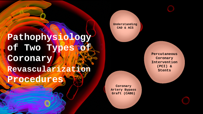 Pathophysiology of PCI & CABG by Donna-May Bernard on Prezi