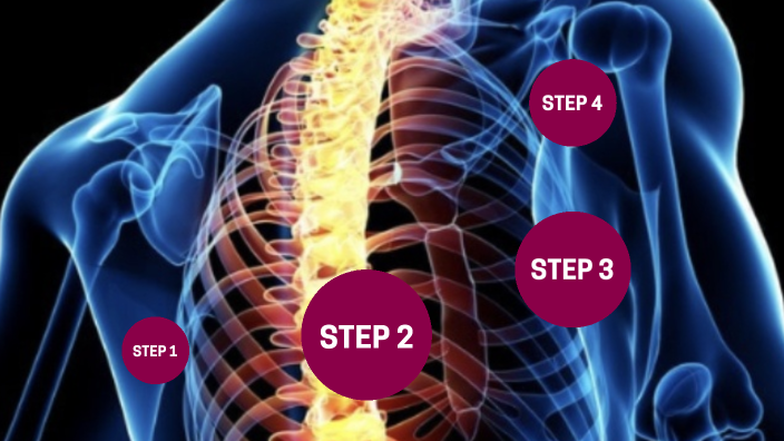 Lésion de la moelle épinière by Clara Manceau on Prezi