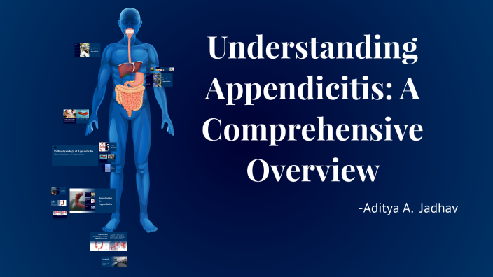 Understanding Appendicitis: A Comprehensive Overview for Nursing ...