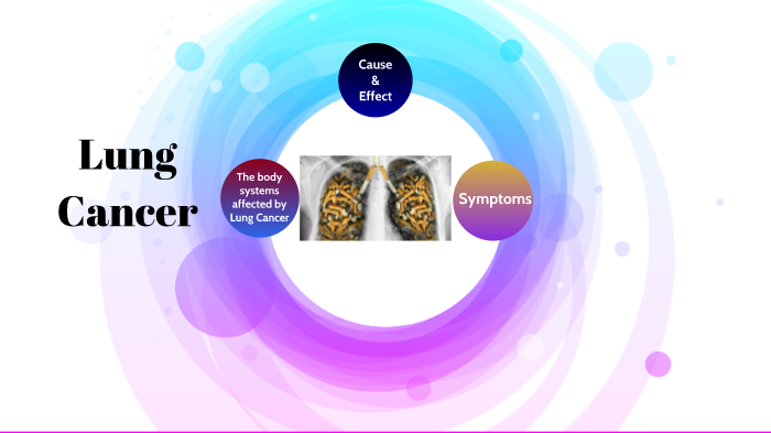 Devin Marquis' Lung Cancer Presentatio by OPK Apollo on Prezi