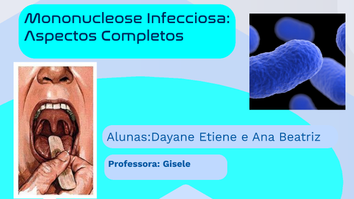 Mononucleose Infecciosa: Aspectos Completos by dayane etiene souza ...