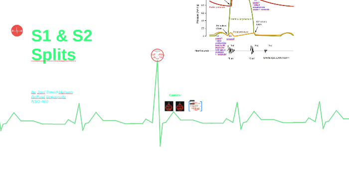 S1 & S2 Splits by Joel Hutson on Prezi