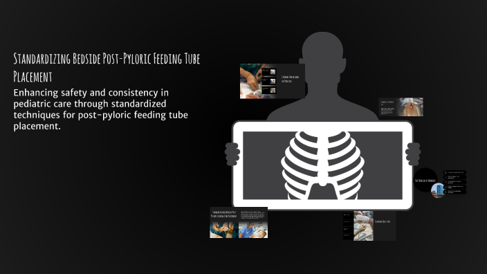 Standardizing Bedside Post-Pyloric Feeding Tube Placement by Emilia Rue ...