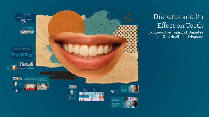 Diabetes and Its Effect on Teeth by Mohamed Hegazy on Prezi