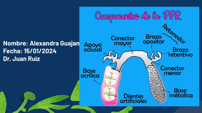 Partes de una PPR by Alexandra Guajan on Prezi