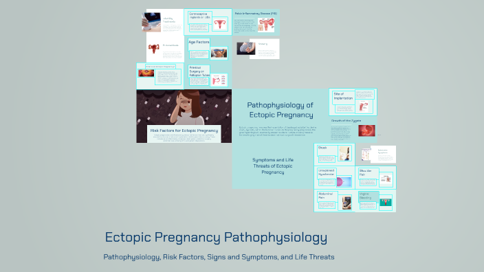 Ectopic Pregnancy Pathophysiology by Calvin Wang on Prezi