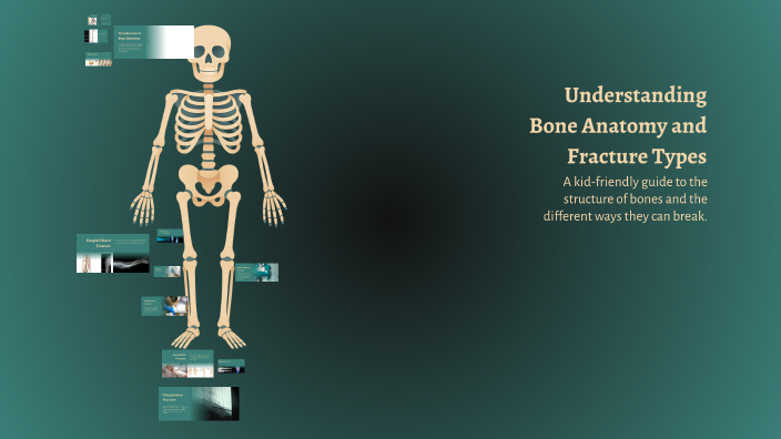Understanding Bone Anatomy and Fracture Types by Alisson Reyes on Prezi