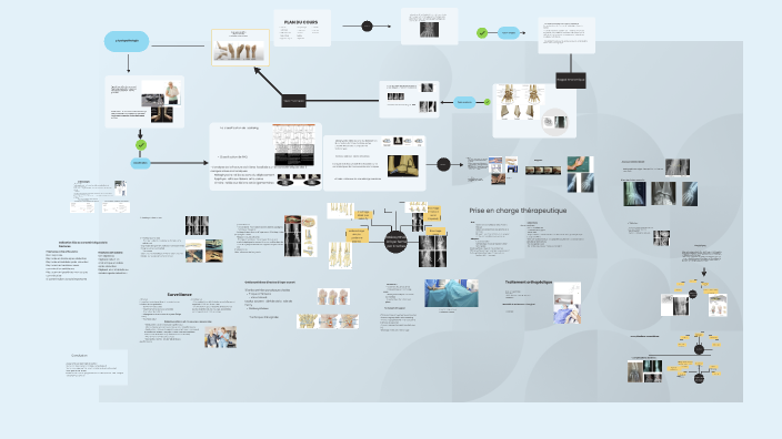 Fractures de l’extrémité distale du radius by Soufiane Ait Salah on Prezi