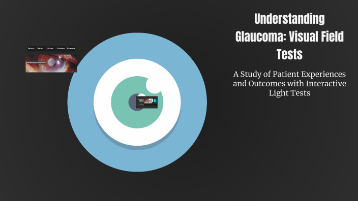 Understanding Glaucoma: Visual Field Tests by Ramon Berrios on Prezi
