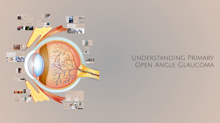 Understanding Primary Open Angle Glaucoma by Mahnoor Akram on Prezi