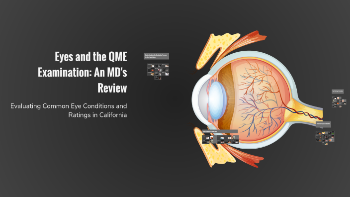 Eyes and the QME Examination: An MD's Review by David Lazar on Prezi