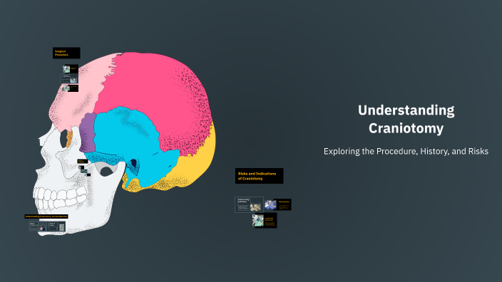 Understanding Craniotomy by MUHAMMAD ADDIN BIN JASMAH on Prezi