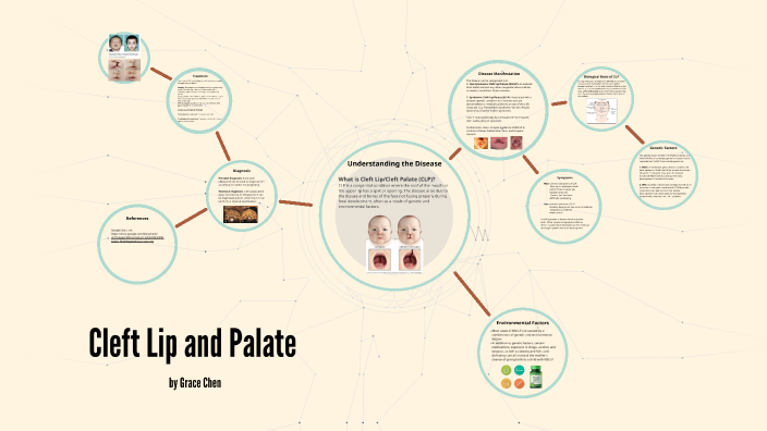 Cleft Lip and Palate by Grace Chen on Prezi
