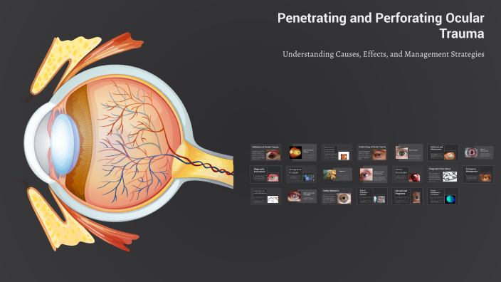 penetrating and perforating ocular trauma by Lkhamsuren Gansukh on Prezi