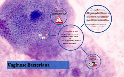 Vaginose Bacteriana by vinicius keller on Prezi