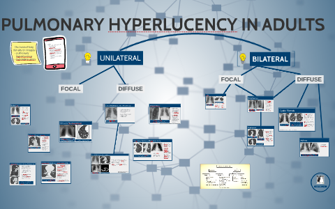 PULMONARY HYPERLUCENCY IN ADULTS by kate pimentel on Prezi