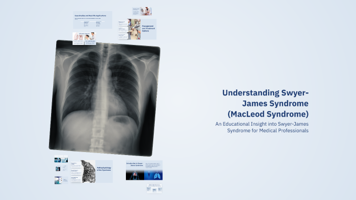 Understanding Swyer-James Syndrome (MacLeod Syndrome) by Yaser Al-hazmy ...