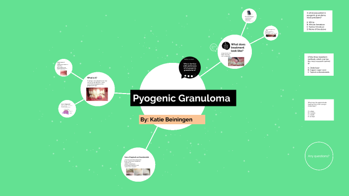 Pyogenic Granuloma by Katie Beiningen on Prezi