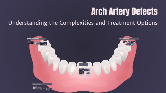 Arch Artery Defects by Emma Gilbertsen on Prezi