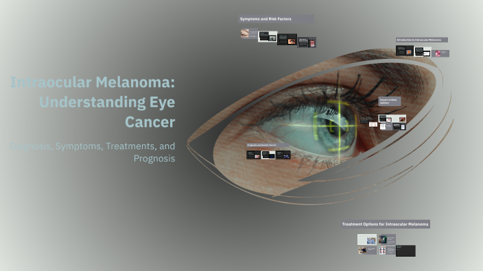 Intraocular Melanoma: Understanding Eye Cancer by Yasir Matar on Prezi