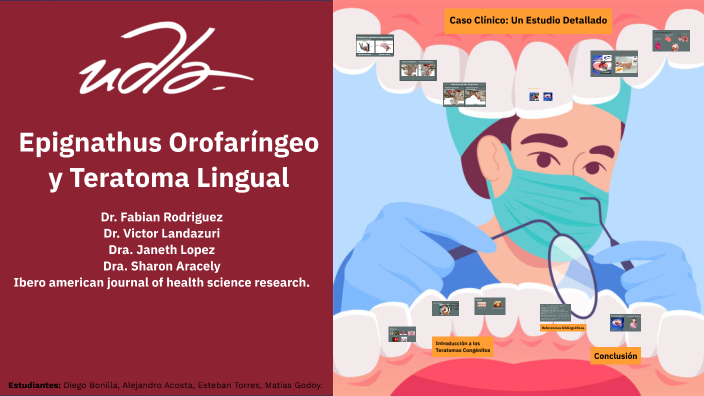 Epignathus Orofaríngeo y Teratoma Lingual by Alejandro Acosta on Prezi