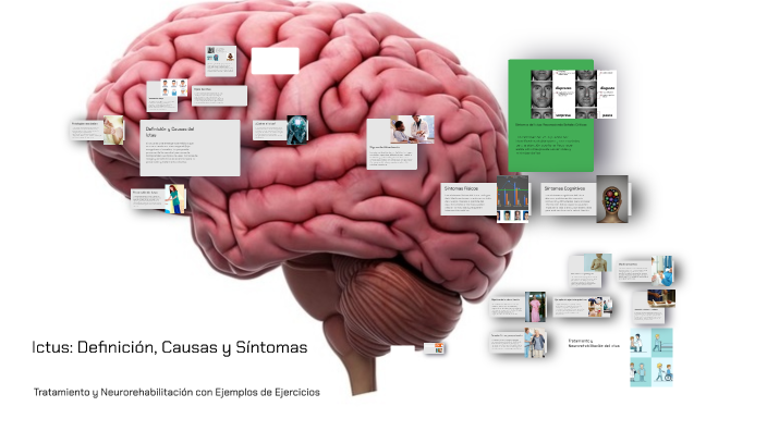 Ictus: Definición, Causas y Síntomas by ALEJANDRA ANDREA HUAMÁN QUESADA ...