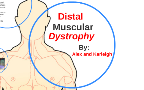 DISTAL MUSCULAR DYSTROPHY by Alex Trejo