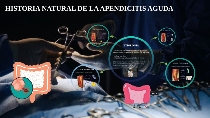 Fases de la Apendicitis by Brandon Galindo Zevallos on Prezi